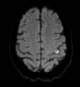 The Omega Sign – Raven Neurology Review